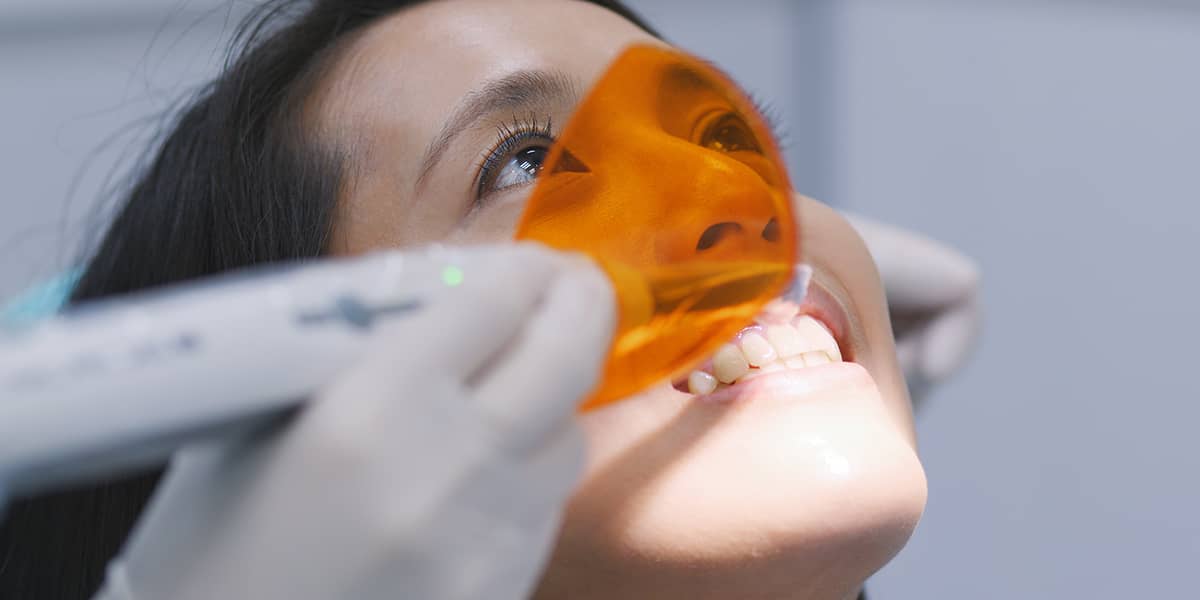 Expert Dental Restoration Services in San Francisco | Post Street Dental