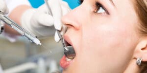 What is A Calculus bridge | Post St Dental Group